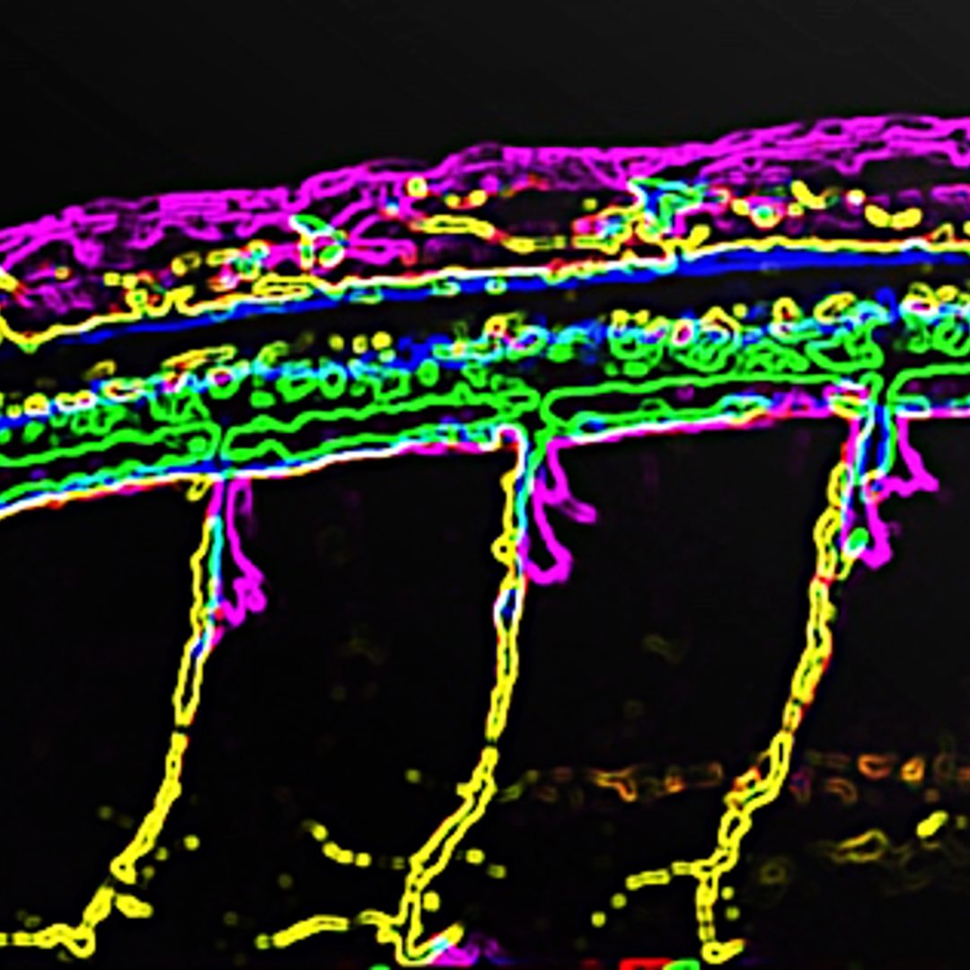 BOMONT - INMG - PGNM